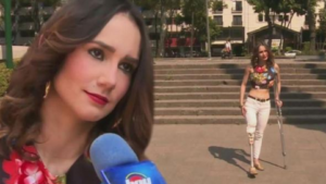 Modelo termina con pierna amputada tras atenderse una gripa en México ...